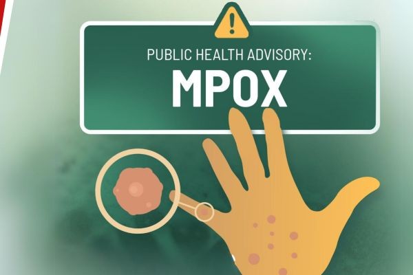 Publiko mag-obserba sa posibleng sintomas ng MPOX - MNAO Lupi | BRIGADA ...