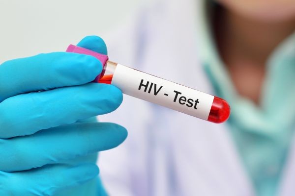 HIV cases sa Pilipinas, tumaas | BRIGADA BALITA